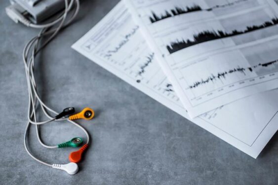 Holter Nedir? Neden Takılır? - MaksatBilgi